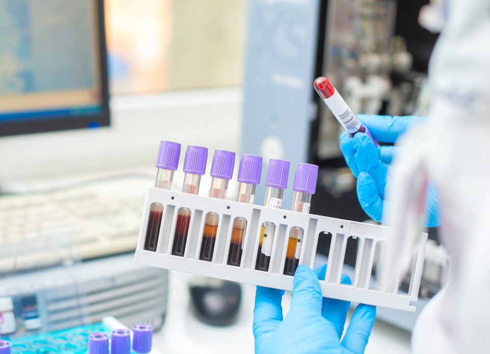 The value of an interlaboratory quality control (ILQC) program - Streck