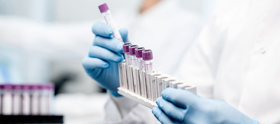 Quality control in the laboratory - Streck