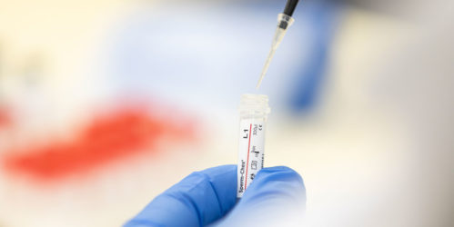 Cell-Chex Cerebrospinal & Body Fluid Control - Streck