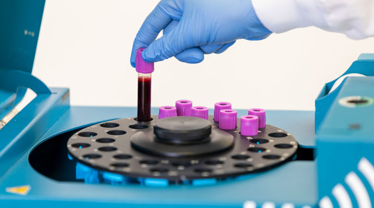 Diesse CUBE 30 Touch Automated ESR Analyzer - Streck