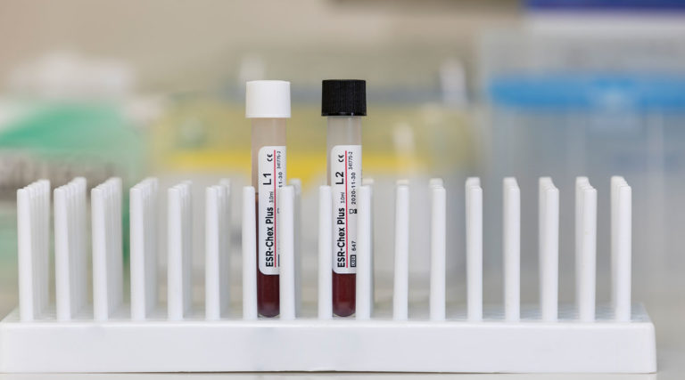 ESR-Chex Plus Sed-Rate Control - Streck