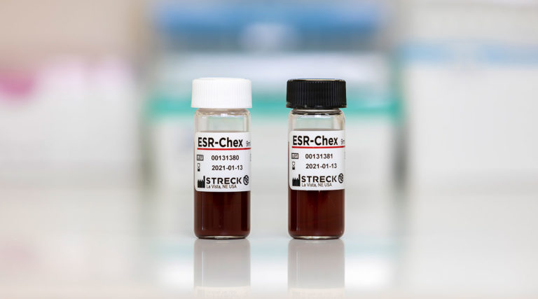ESR-Chex Sed-Rate Control - Streck