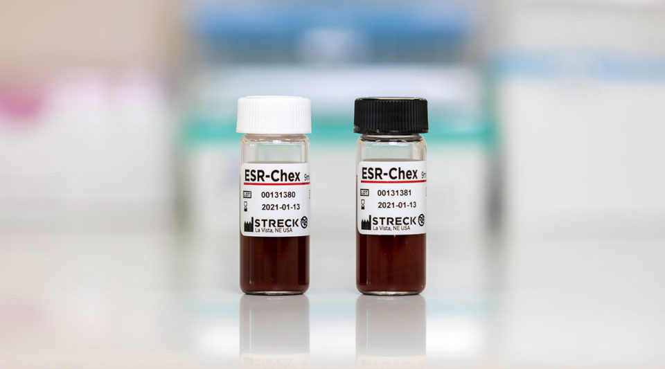 ESR-Chex Sed-Rate Control - Streck