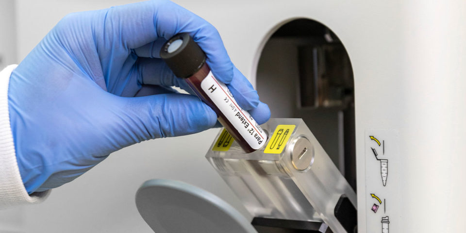 Retic-Chex II Whole Blood Hematology Control - Streck