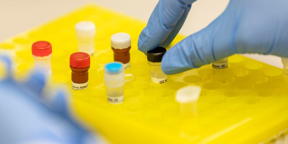 MDx-Chex for BCID2 Molecular Control - Streck