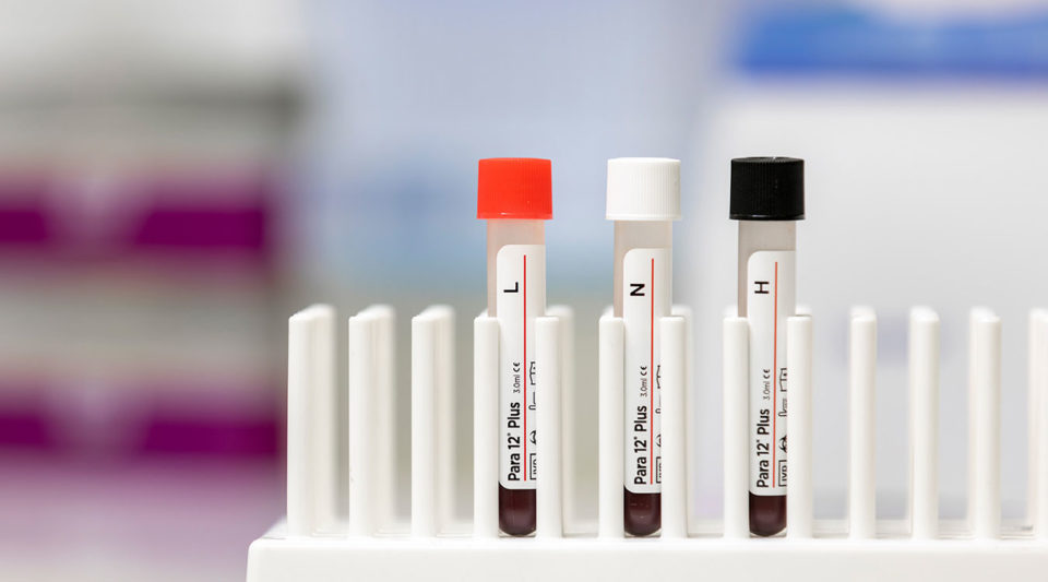 Para 12 Plus 5-Part Differential Hematology Control - Streck