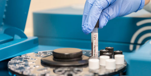 Diesse MINI-CUBE Automated ESR Analyzer | Streck