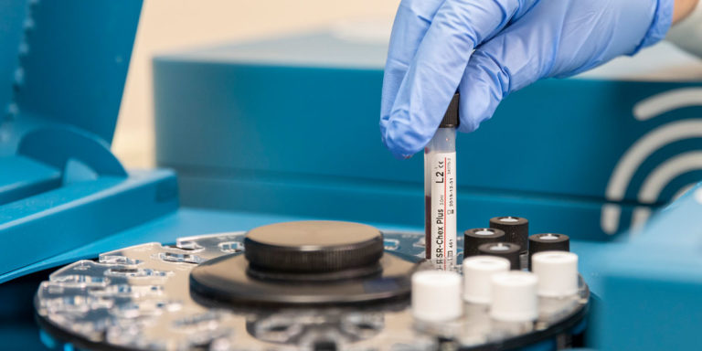 Diesse MINI-CUBE Automated ESR Analyzer | Streck