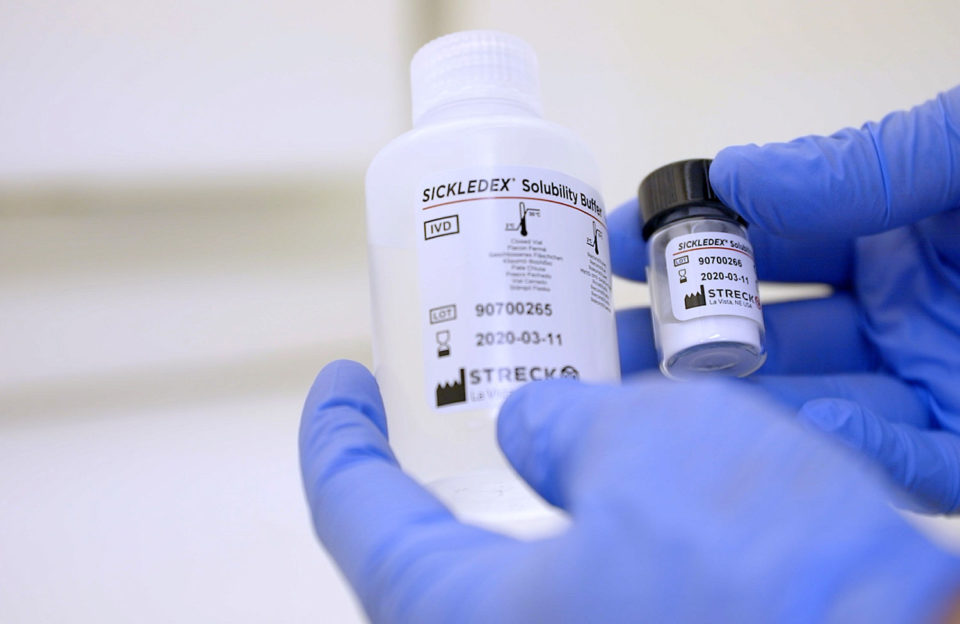 Sickle Cell - Streck