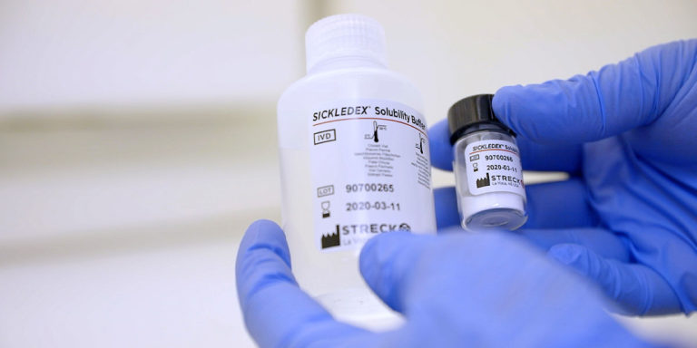SICKLEDEX Testing Kit for Hemoglobin S - Streck