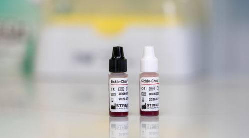 Sickle-Chex Positive & Negative Whole Blood Control - Streck