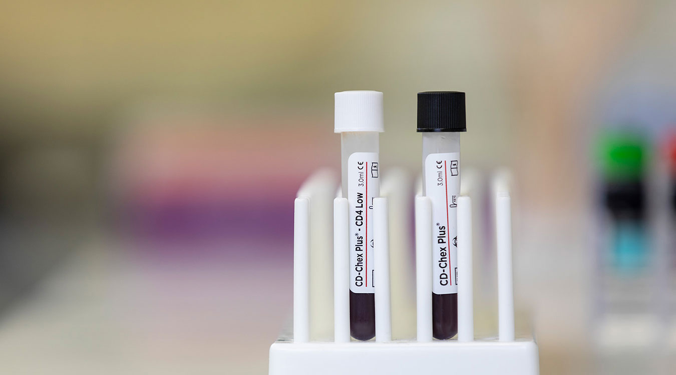 Accellix Inc. and Streck collaborate to advance cell therapy with ...