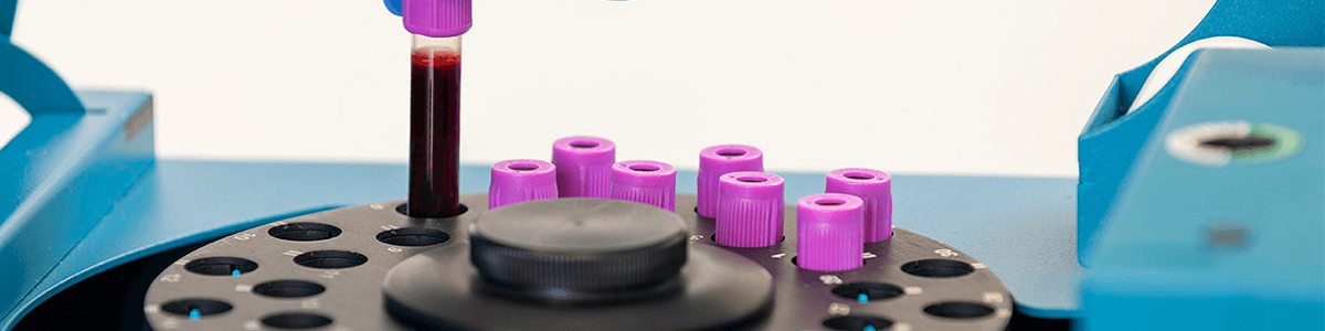 Diesse CUBE 30 Touch Automated ESR Analyzer - Streck