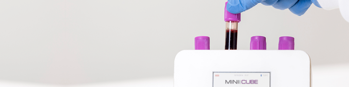 Diesse MINI-CUBE Automated ESR Analyzer - Streck