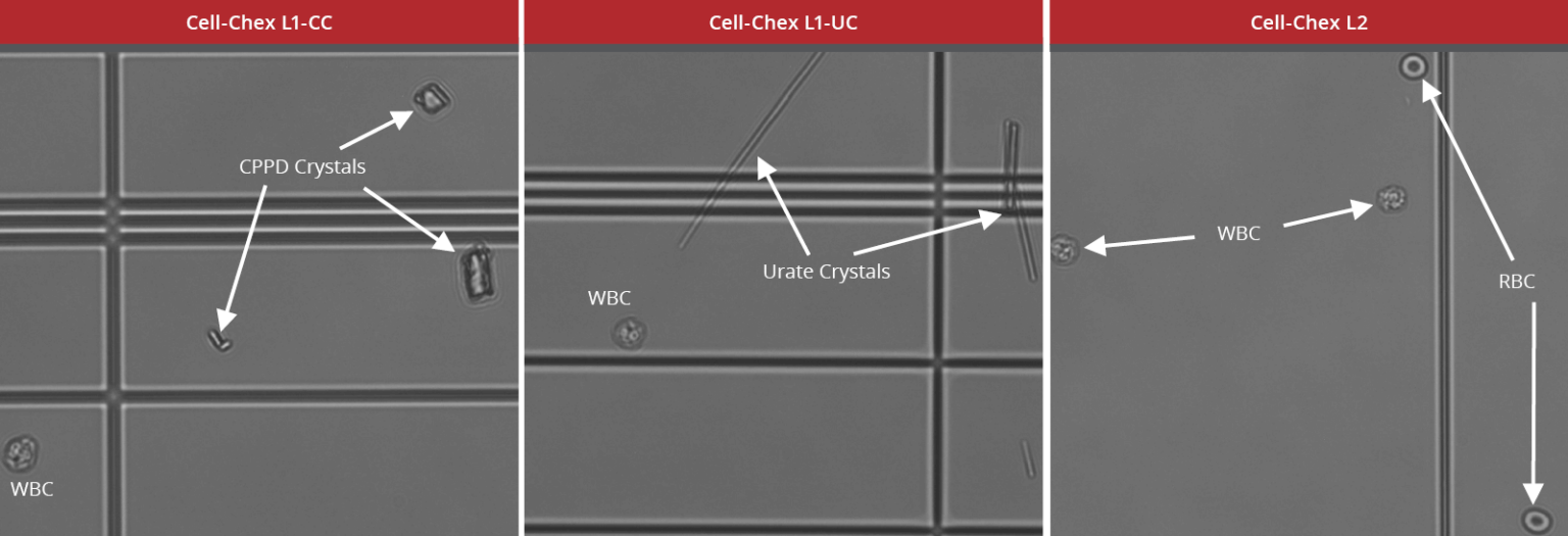 Cell-Chex Cerebrospinal & Body Fluid Control - Streck