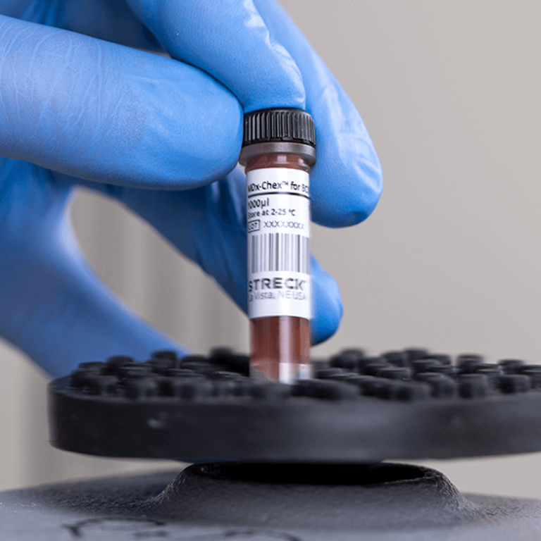 New IQCP template for MDx assays - Streck