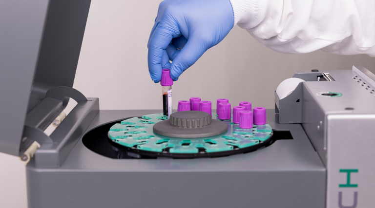 Diesse CUBE 30 Touch Automated ESR Analyzer - Streck