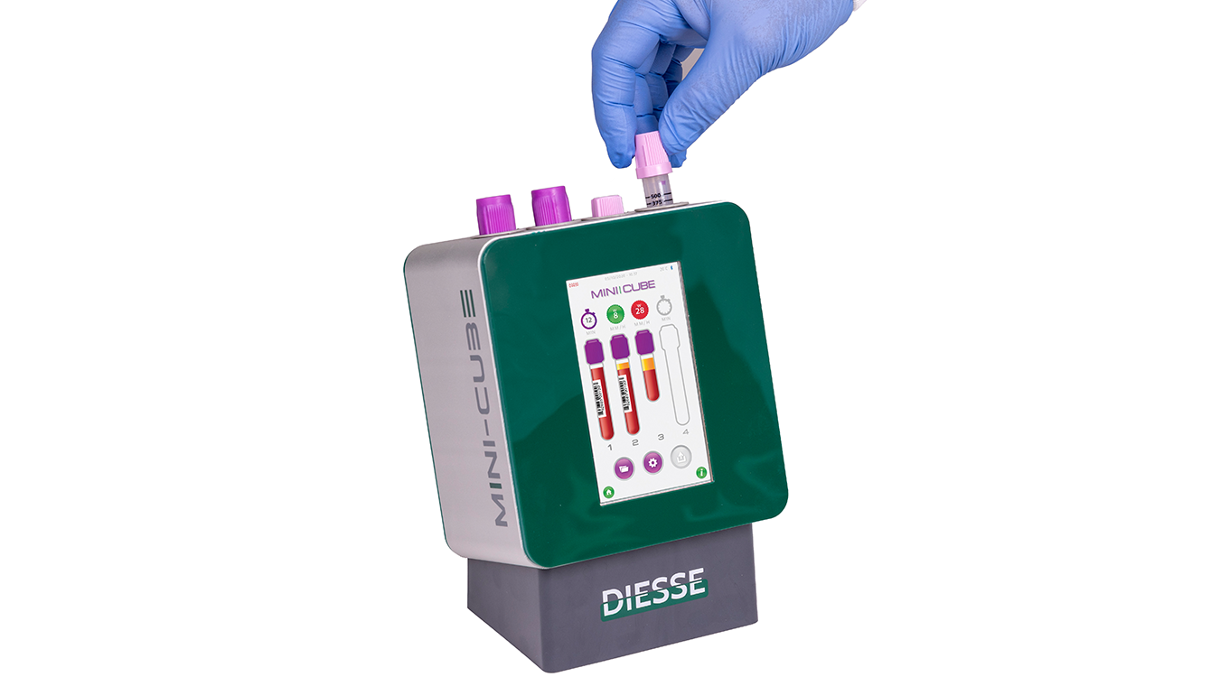 Diesse MINI-CUBE Automated ESR Analyzer - Streck