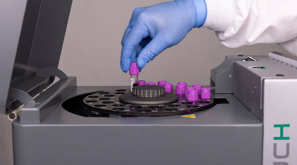 Diesse CUBE 30 Touch Automated ESR Analyzer - Streck