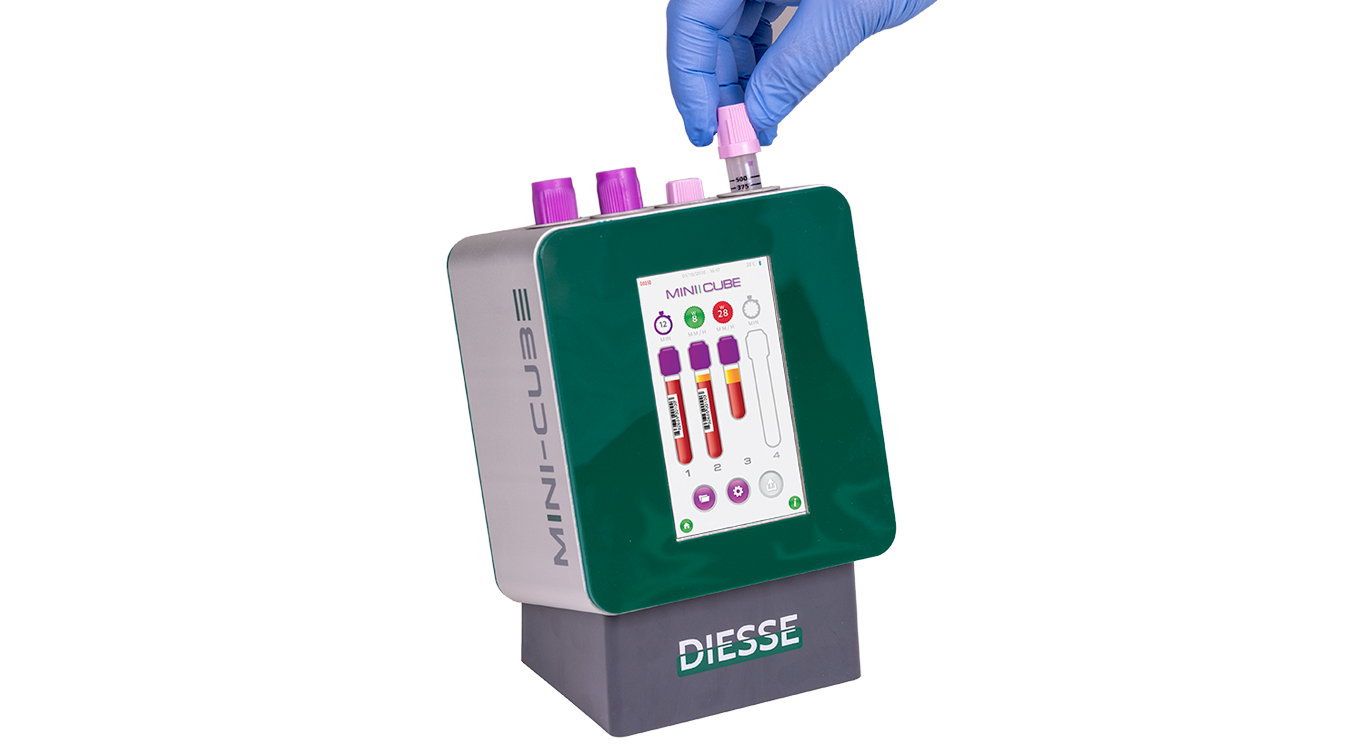 Diesse MINI-CUBE Automated ESR Analyzer - Streck