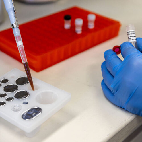 Leveraging Syndromic Testing for Improved Patient Care - Streck